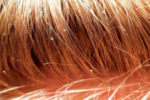 Baka ilipad ka ng kuto mo | Bandera