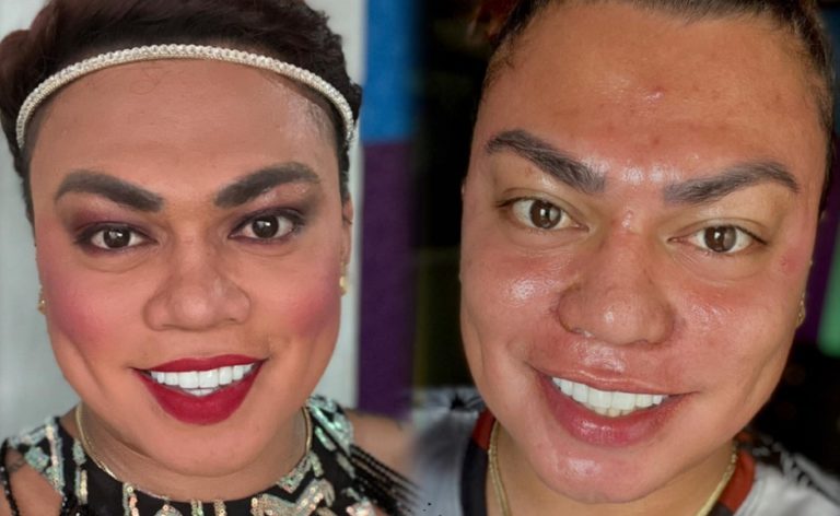 Brenda Mage nagparetoke ng ilong, sey ng netizens: Wala namang nagbago ...