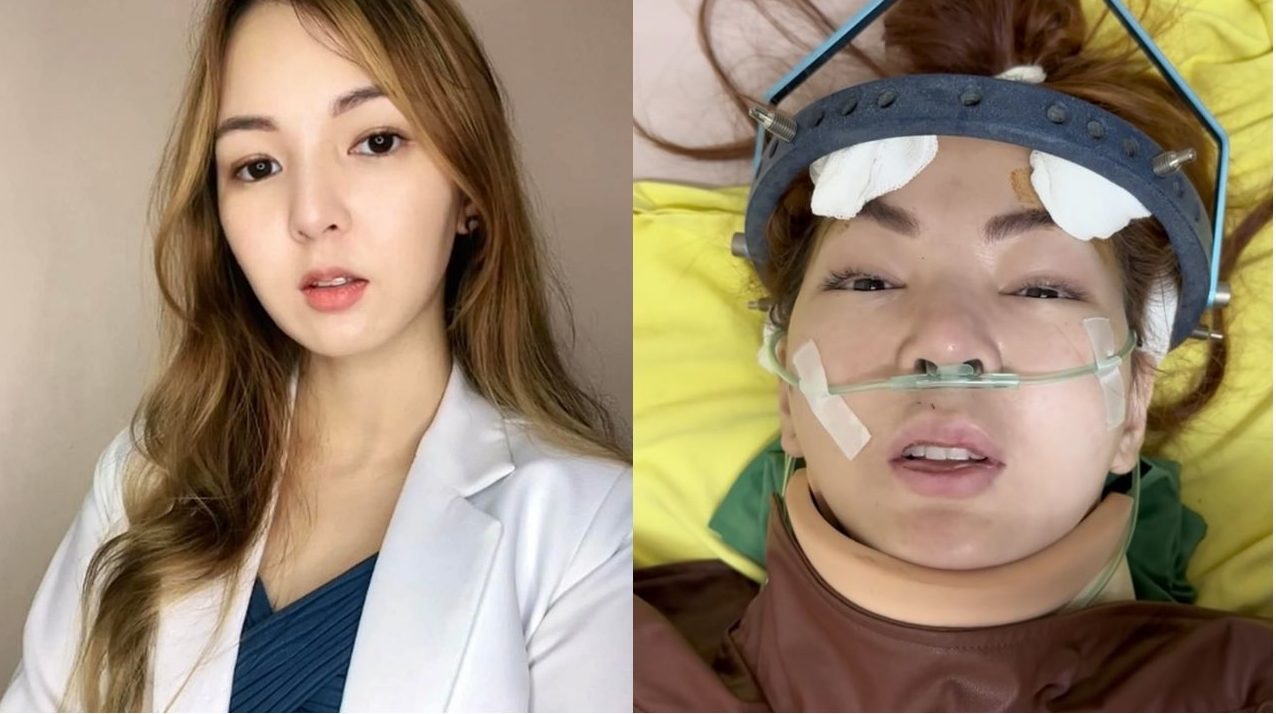 Krizzle Luna naaksidente, ‘di pa makagalaw dahil tinamaan ang ‘spine’ | Bandera