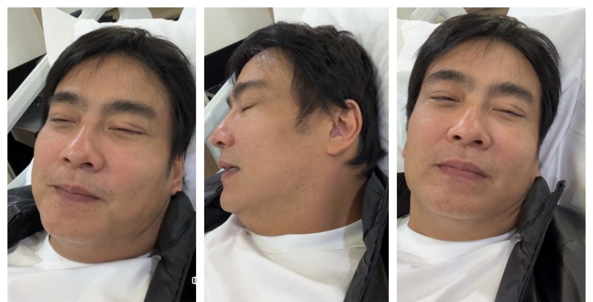 Bong 'naaksidente' sa shooting ng 'Alyas Pogi 4', ooperahan