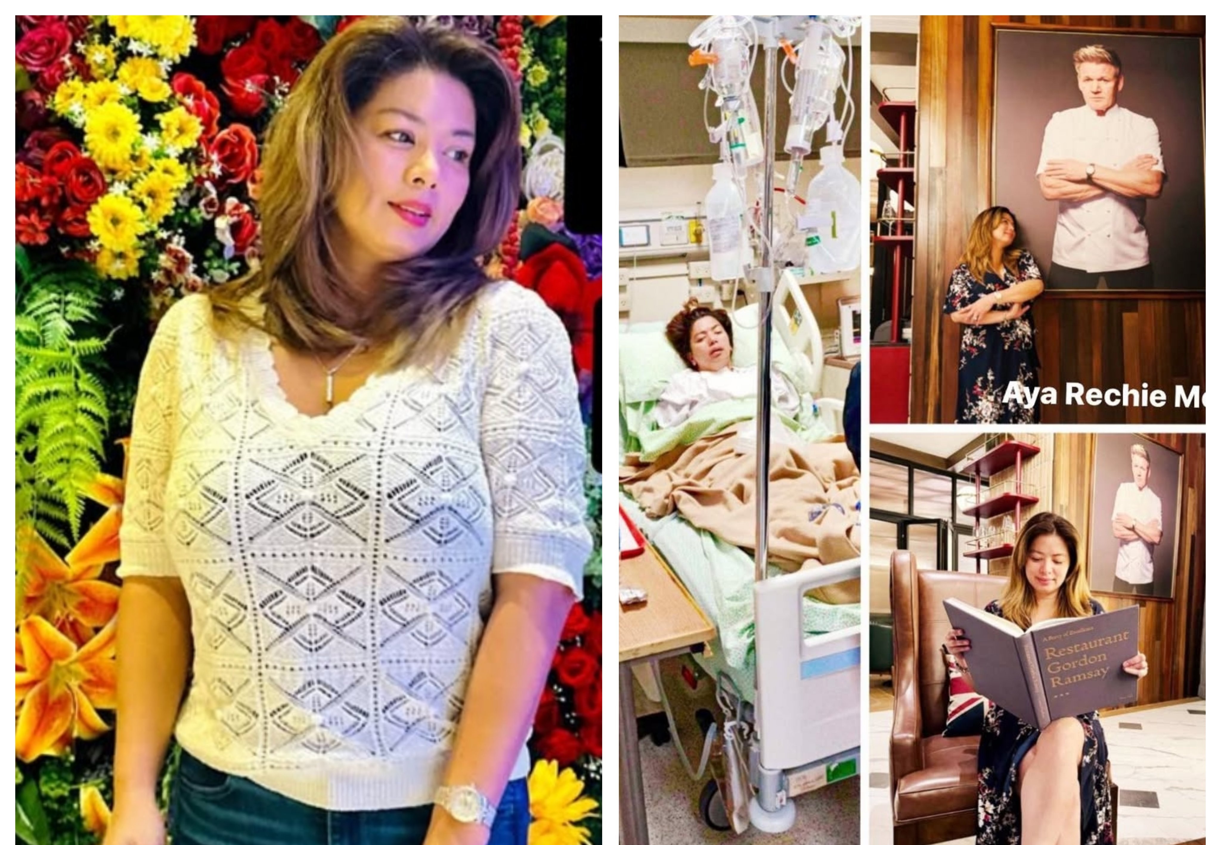 Papaya Queen Aya Medel inalala pagiging brain aneurysm survivor