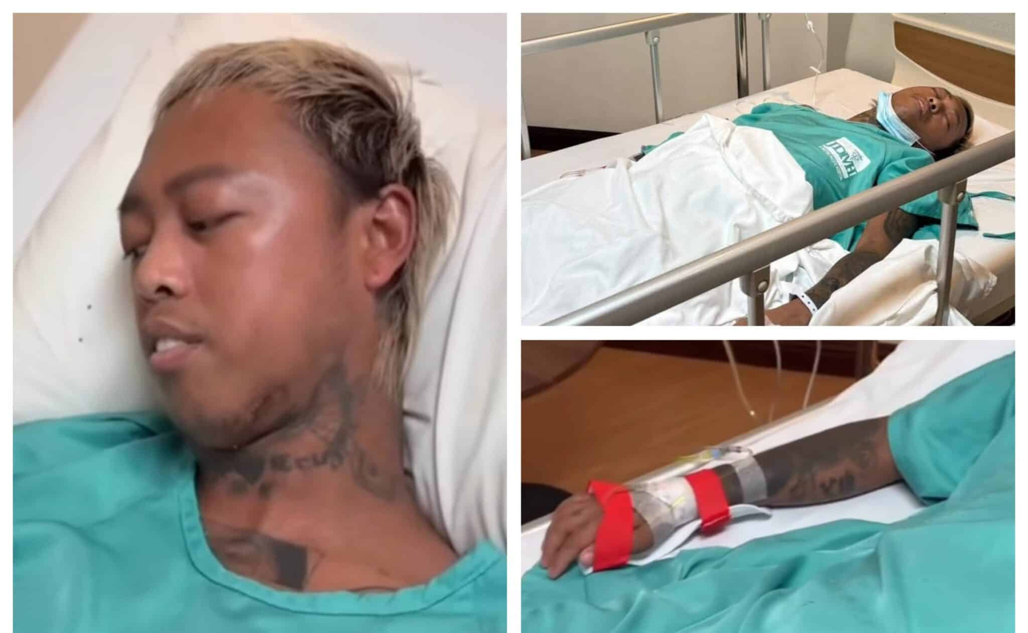 Whamos Cruz nagpa-opera ng luslos, gumastos ng P409K