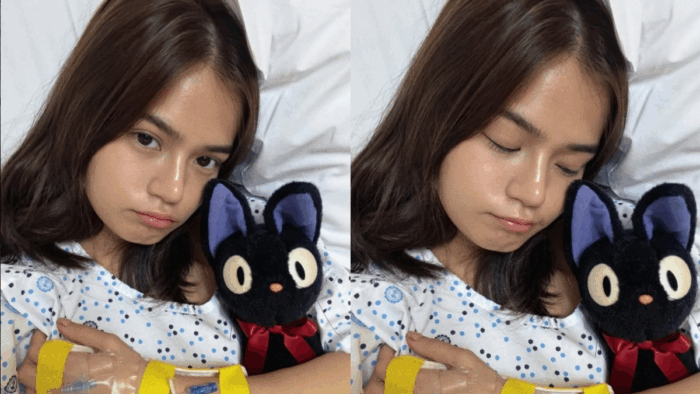 Maris Racal nagpa-surgery, member ng 'walang appendix club'